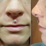 40 Philtrum Piercing (Medusa Piercing) Ideas For The Stylish You ...